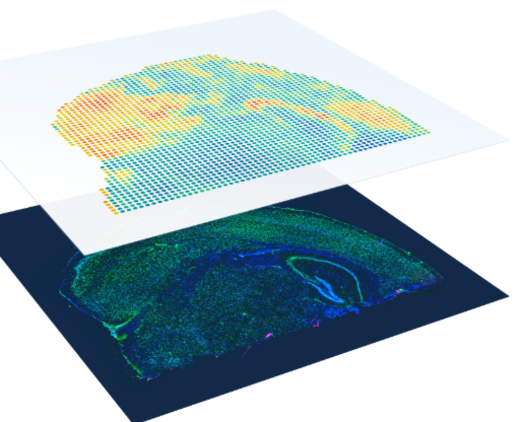 10X Genomics Visium | Iowa NeuroBank Core - Carver College of Medicine ...